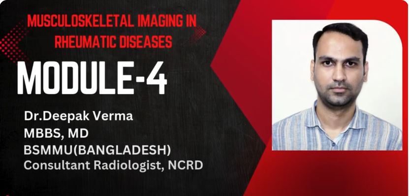 Module 4: Musculoskeletal Ultrasound and Imaging in Rheumatic Diseases ...